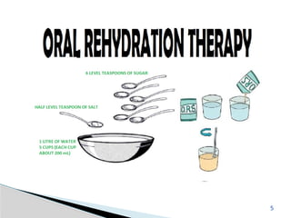 Oral Rehydratioin Therapy in children.pptx