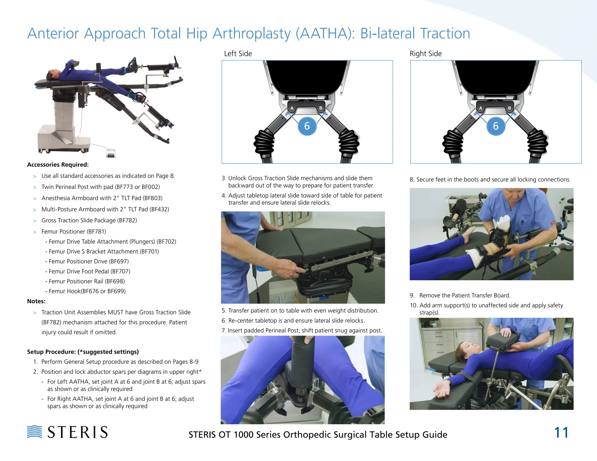 orthopaedic table-ORT1000 set up guide.pdf