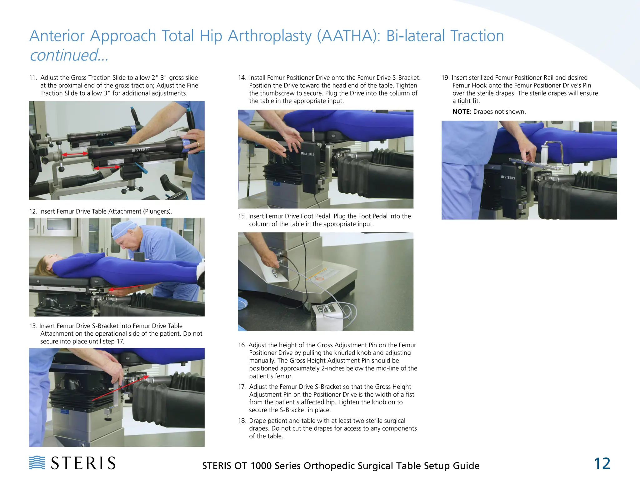 orthopaedic table-ORT1000 set up guide.pdf