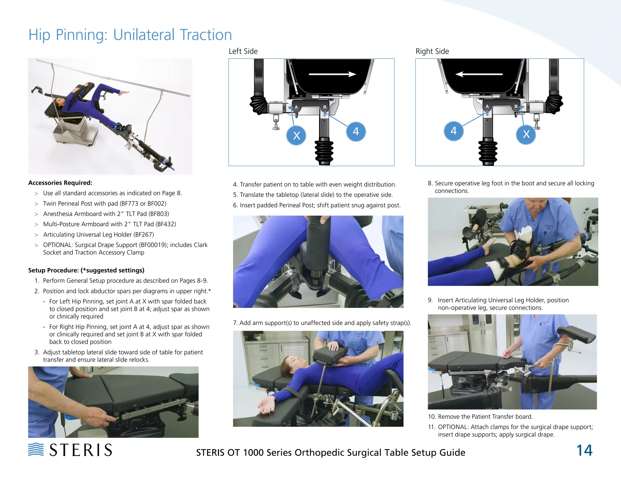 orthopaedic table-ORT1000 set up guide.pdf