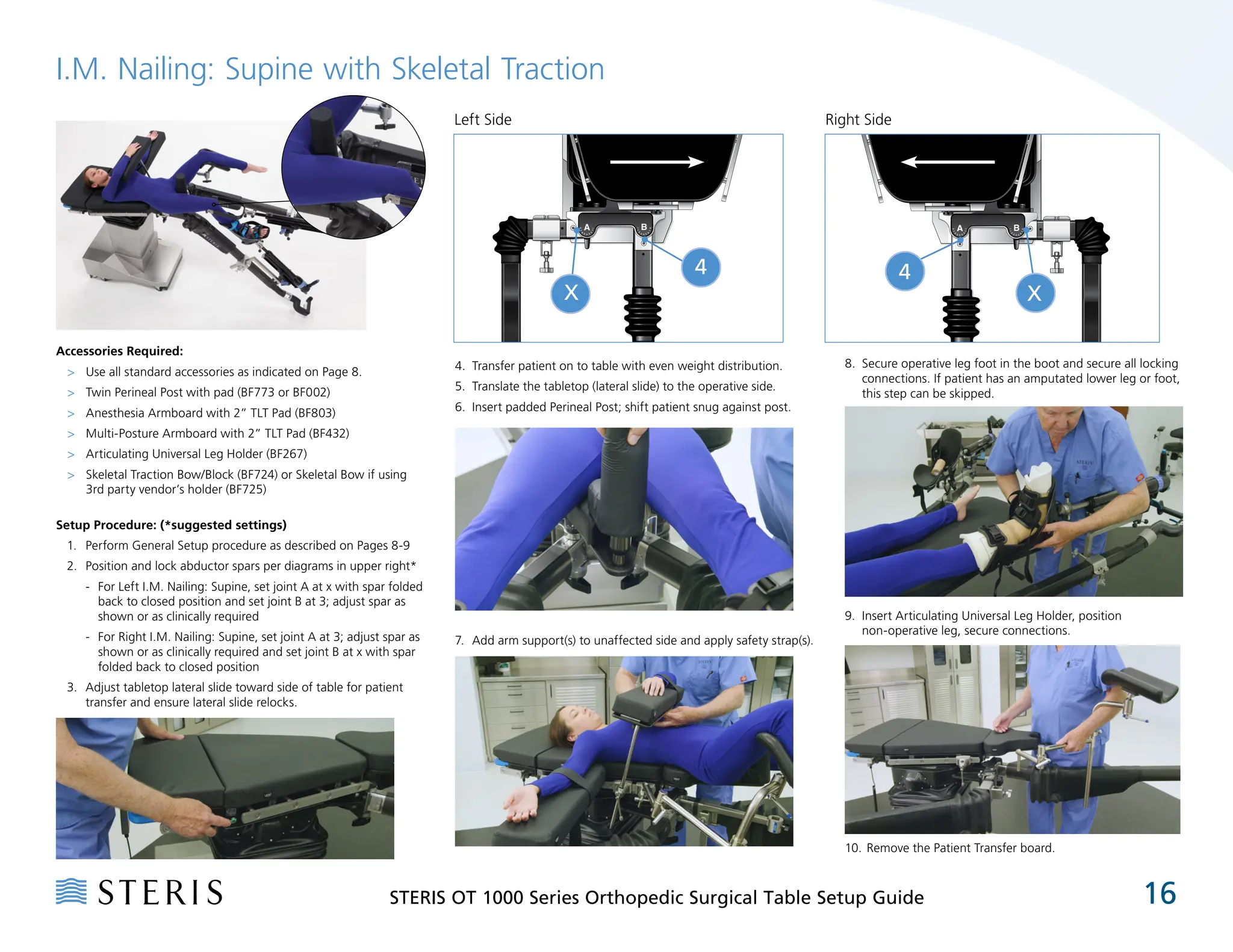orthopaedic table-ORT1000 set up guide.pdf