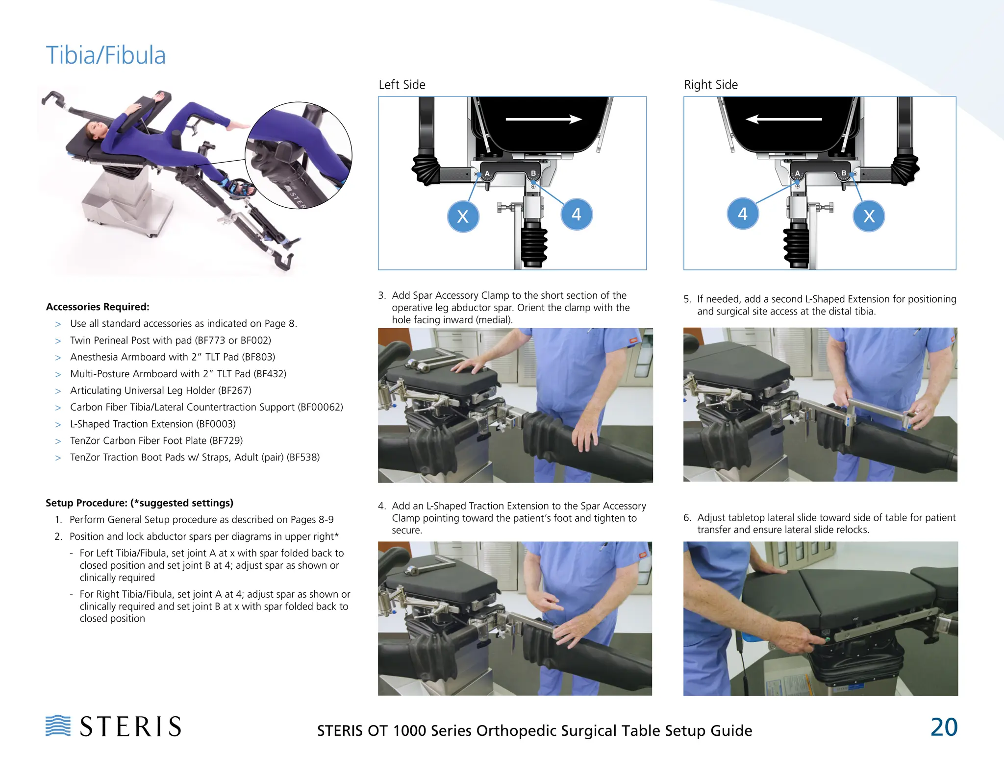orthopaedic table-ORT1000 set up guide.pdf