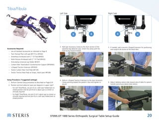 orthopaedic table-ORT1000 set up guide.pdf