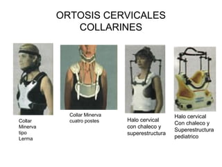 Ortesis cervicales | PPT