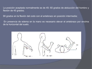 Ortesis hombro y codo | PPTX