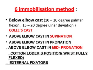 Colle`s and smith`s fracture | PPT
