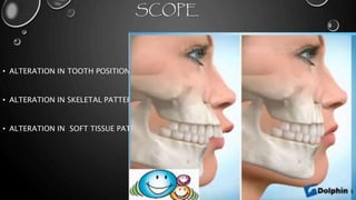 introduction to Orthodontics | PPTX