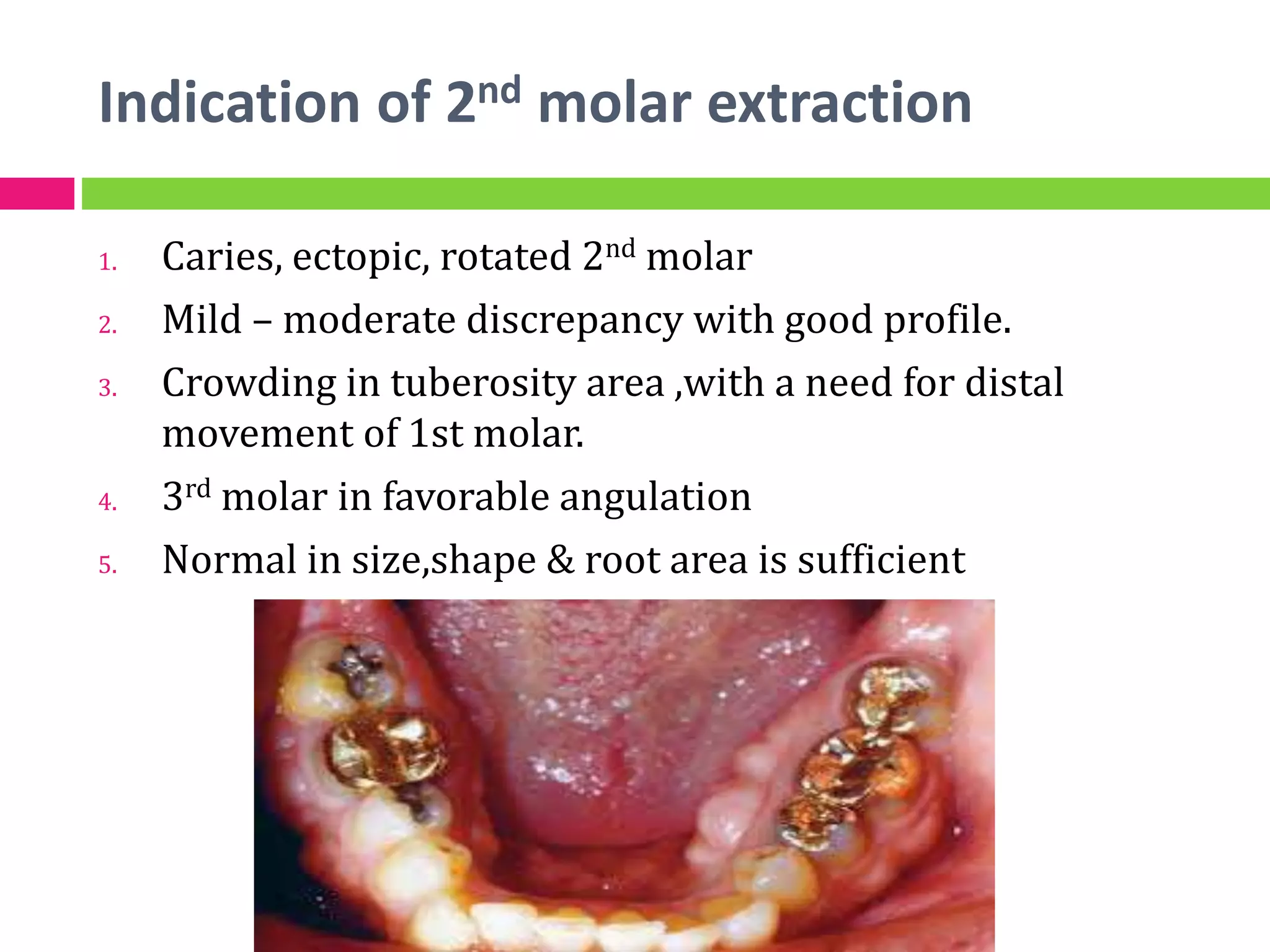 Extraction in Orthodontic Treatment | PPTX