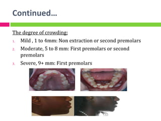 Extraction in Orthodontic Treatment | PPTX