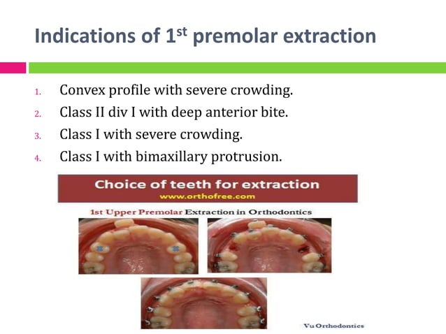 Extraction in Orthodontic Treatment | PPTX