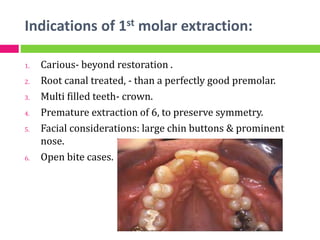 Extraction in Orthodontic Treatment | PPTX