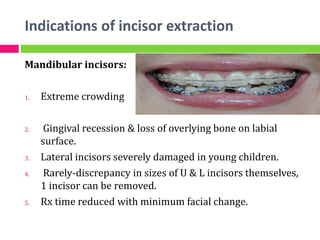 Extraction in Orthodontic Treatment | PPTX