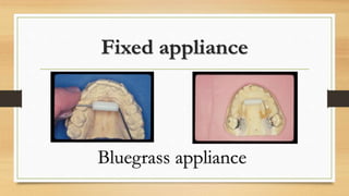 Oral Bad Habits in orthodontics | PPTX