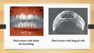 Oral Bad Habits in orthodontics | PPTX