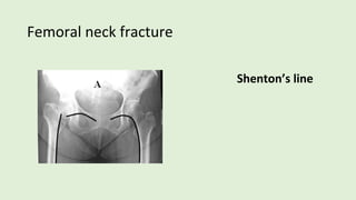 Ortho ธมลวรรณ | PDF