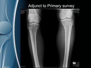 Ortho.. | PDF