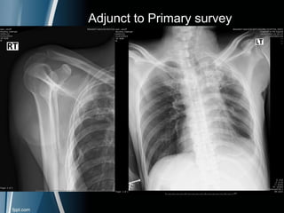 Ortho.. | PDF