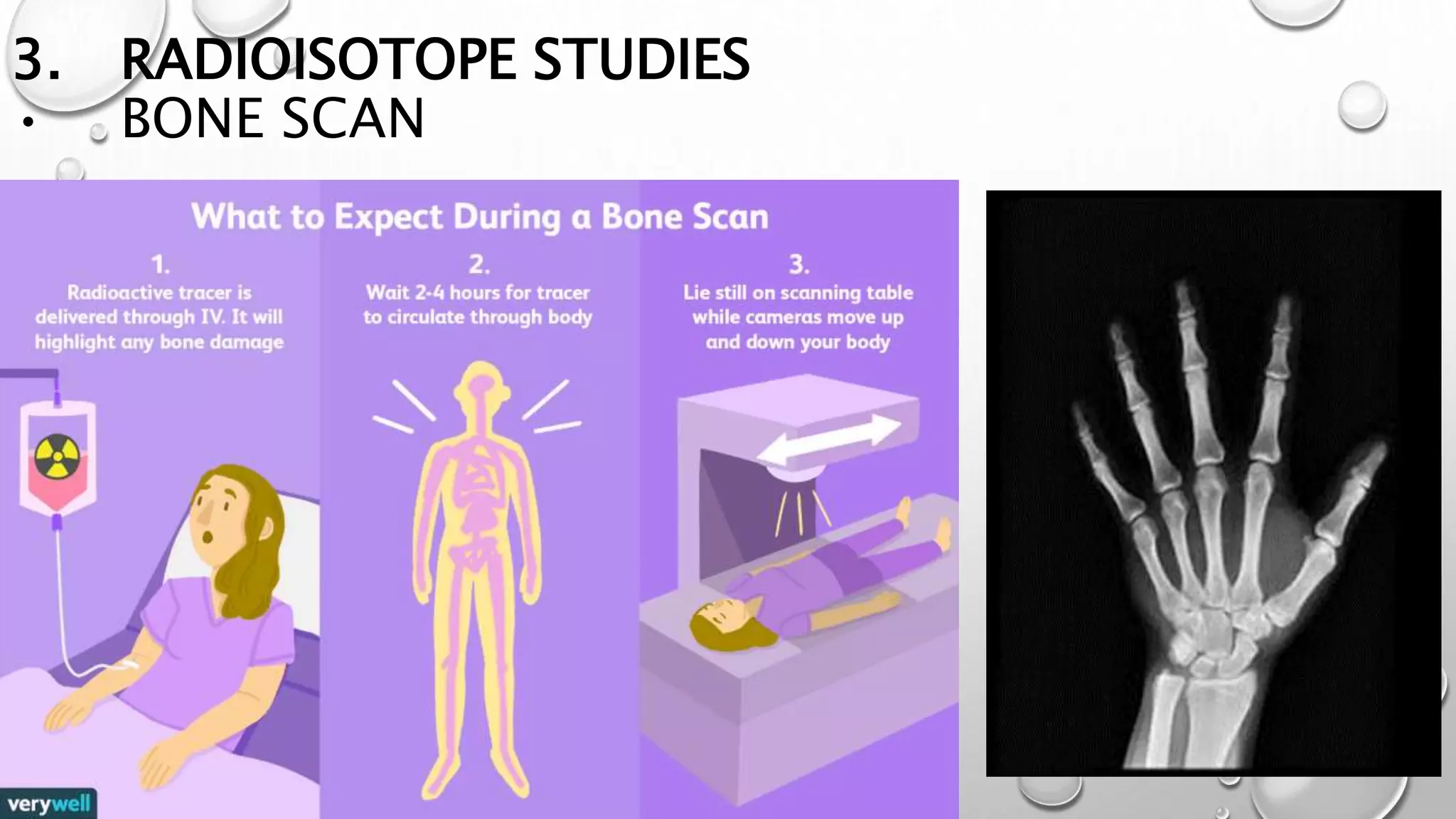 nursing assessment and systemic examination of orthopaedic system | PPTX
