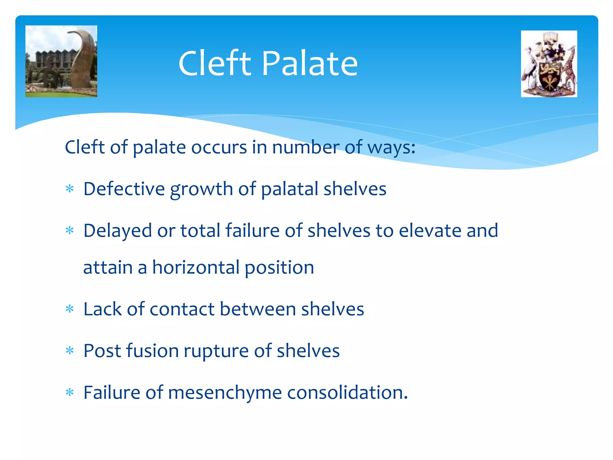 principles of Orthodontic management of cleft lip and palate | PPT