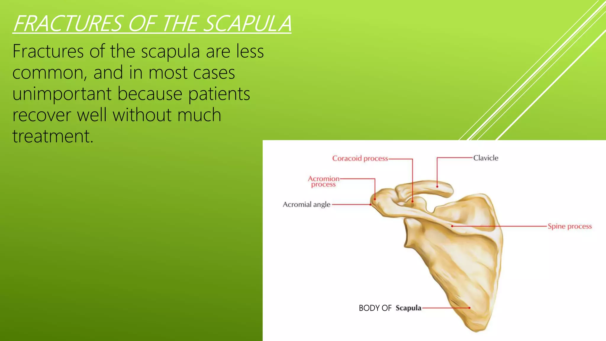 orthopaedics surgery by dr shubham patel | PPTX