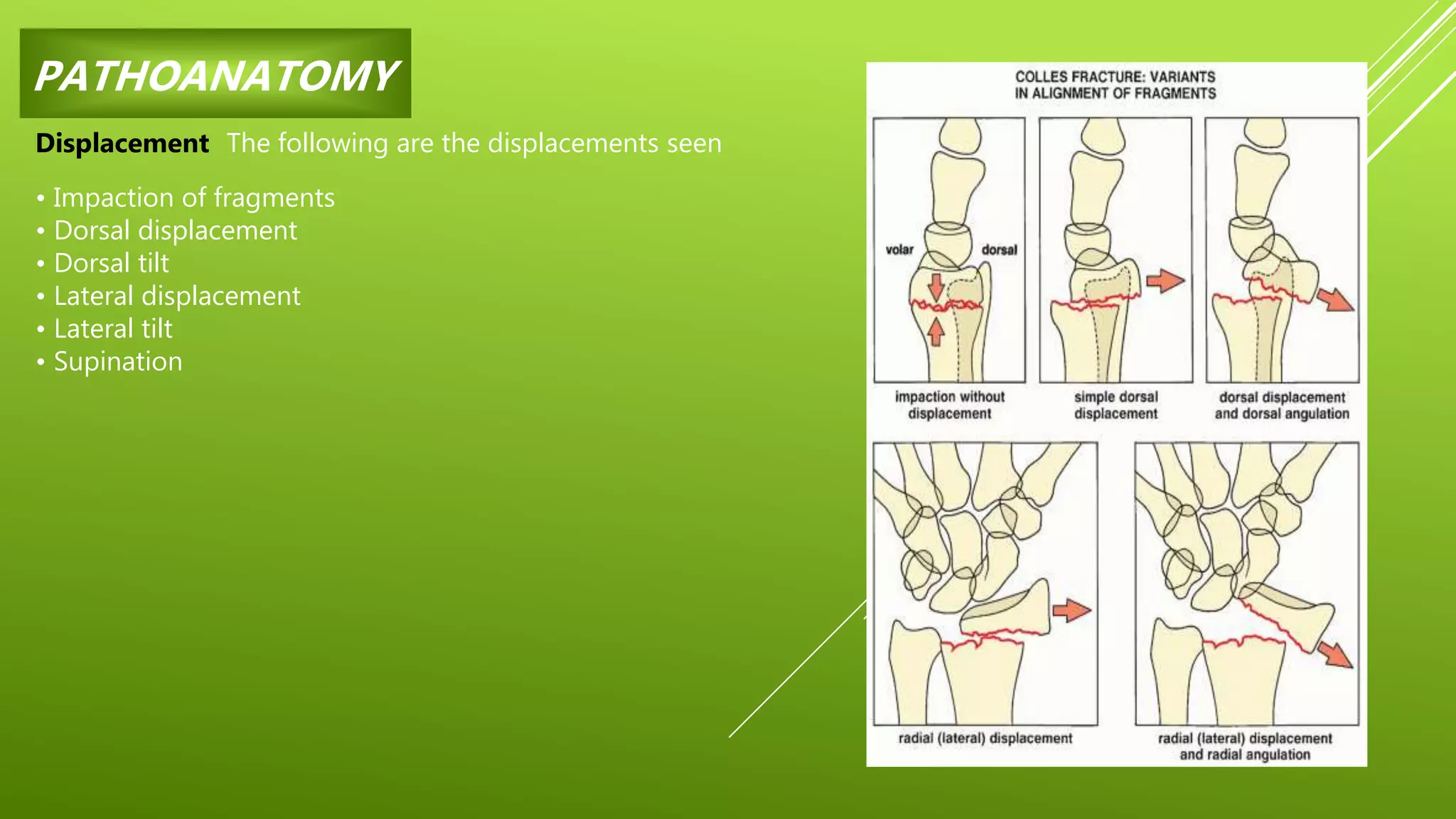 orthopaedics surgery by dr shubham patel | PPTX