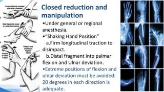Distal end radius, monteggia and galleazi fractures. | PPTX | Death ...