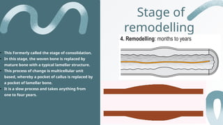 ortho - fracture healing with stages and complications | PPTX