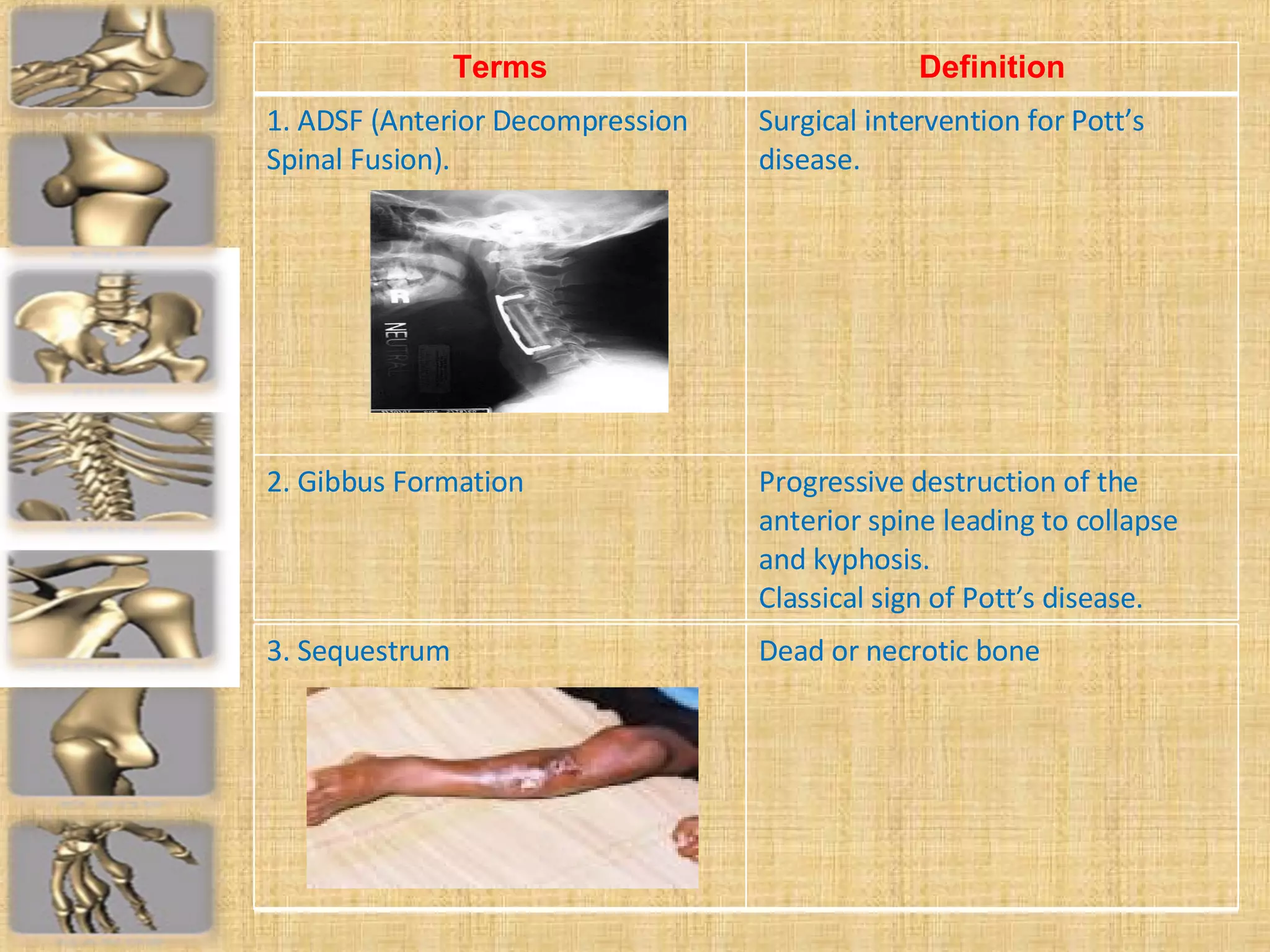 Ortho Hardware | PPT