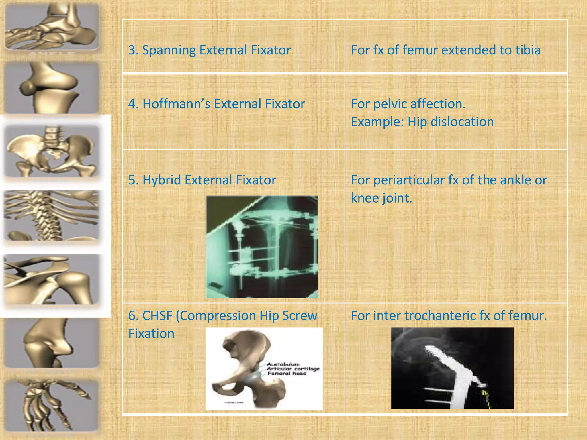 Ortho Hardware | PPT