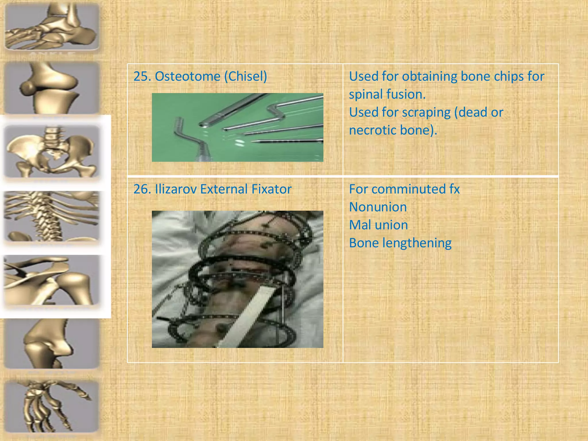 Ortho Hardware | PPT