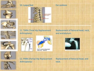 Ortho Hardware | PPT