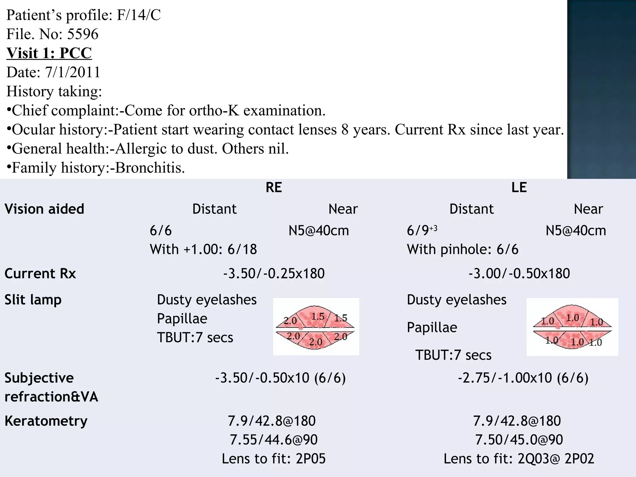 Orthokeratology_Refractive treatment | PPT