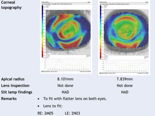 Orthokeratology_Refractive treatment | PPT