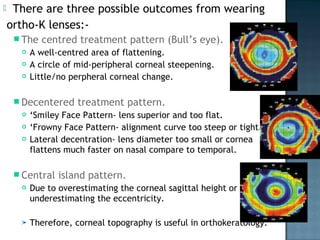 Orthokeratology_Refractive treatment | PPT