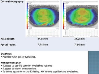 Orthokeratology_Refractive treatment | PPT