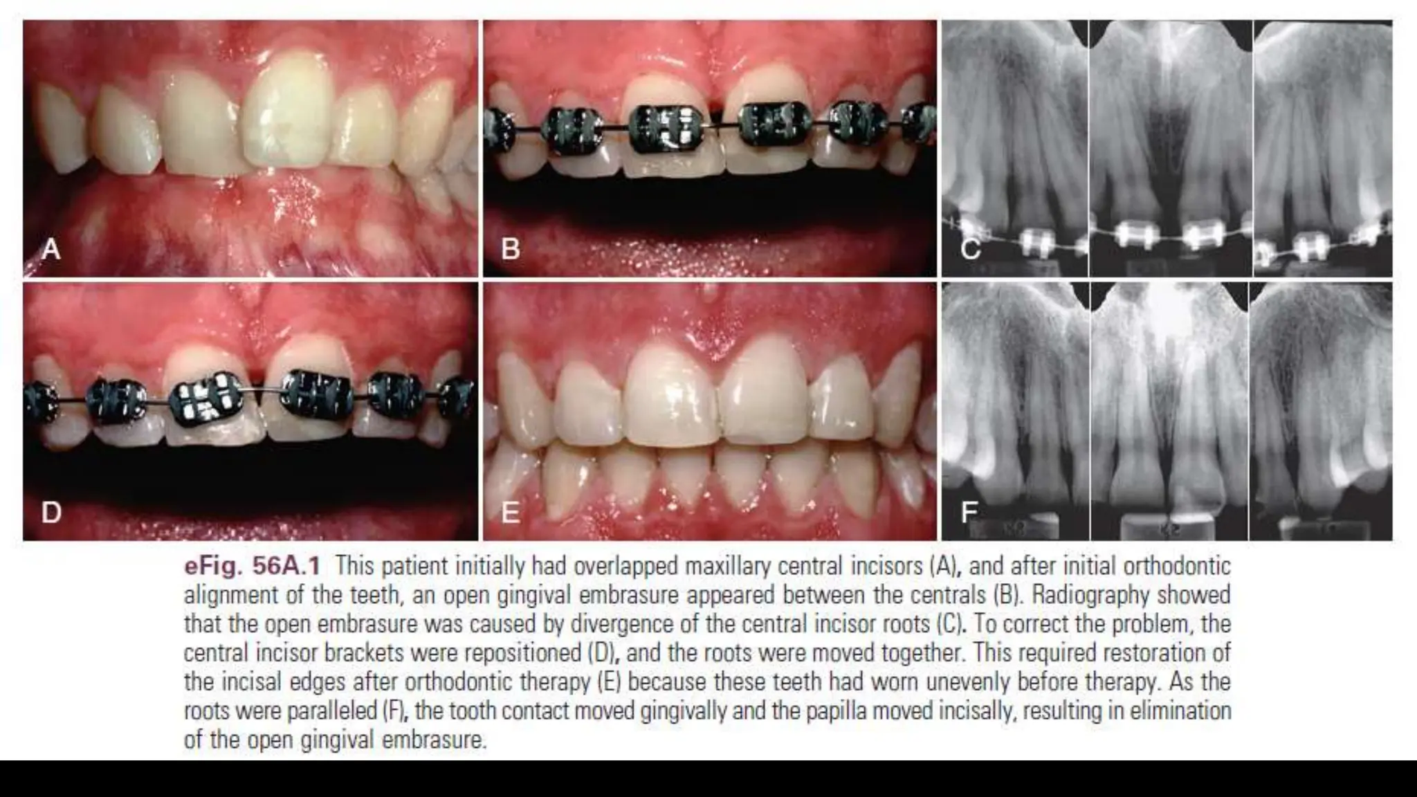 Orthodontist periodontist Ortho-perio lecture .pptx