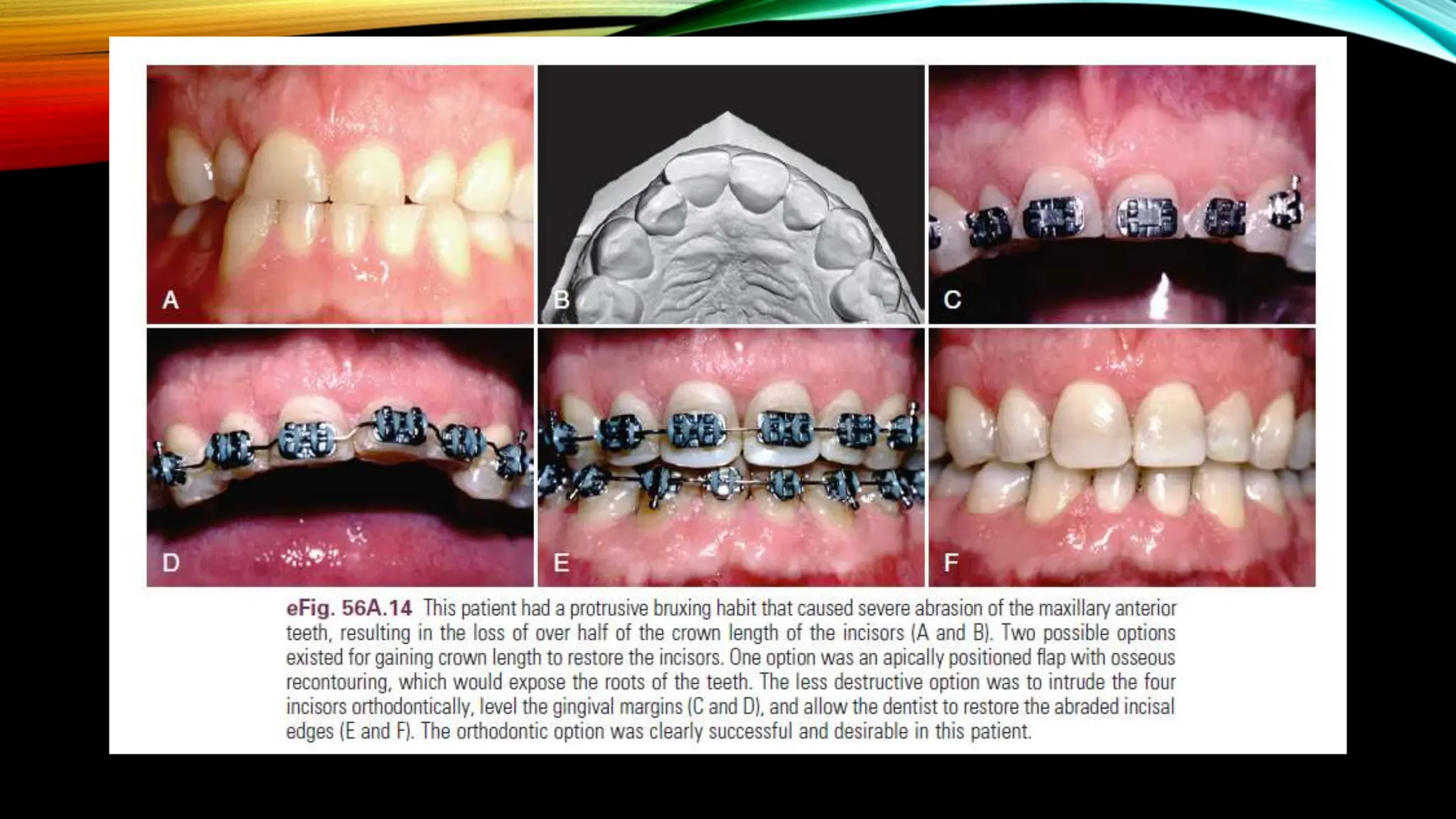 Orthodontist periodontist Ortho-perio lecture .pptx