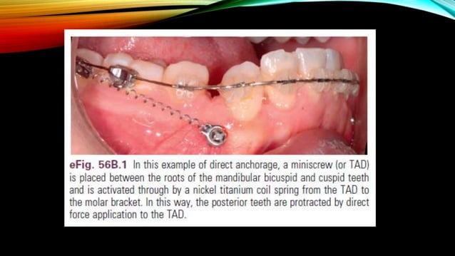 Orthodontist periodontist Ortho-perio lecture .pptx