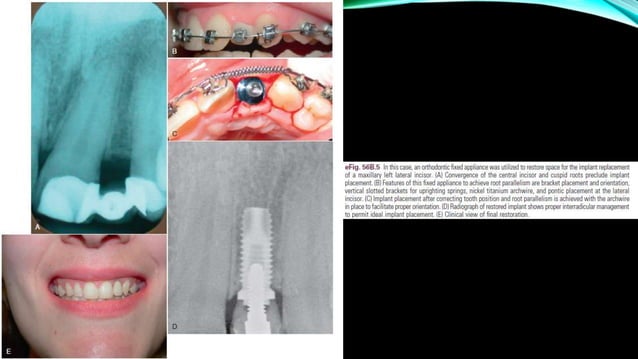 Orthodontist periodontist Ortho-perio lecture .pptx
