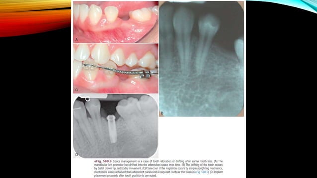 Orthodontist periodontist Ortho-perio lecture .pptx