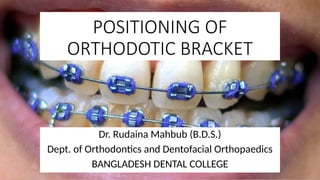 PLACEMENT OF ORTHODOTIC BRACKET. pptx | PPTX