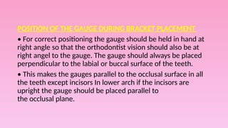 PLACEMENT OF ORTHODOTIC BRACKET. pptx | PPTX