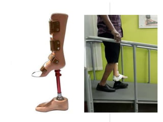 Ortho-prosthesis.pptx