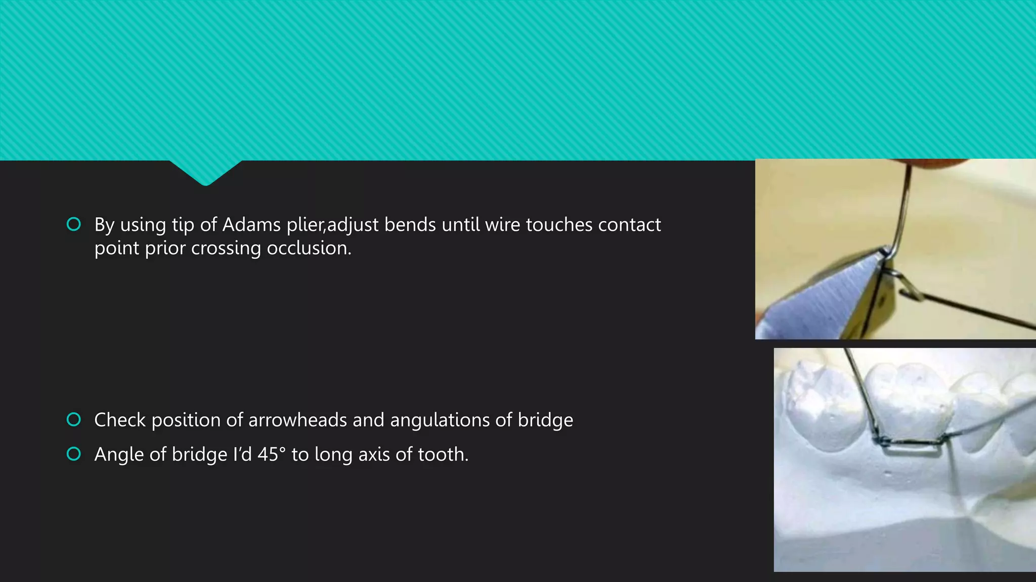 Adams clasp theory and fabrication | PPTX