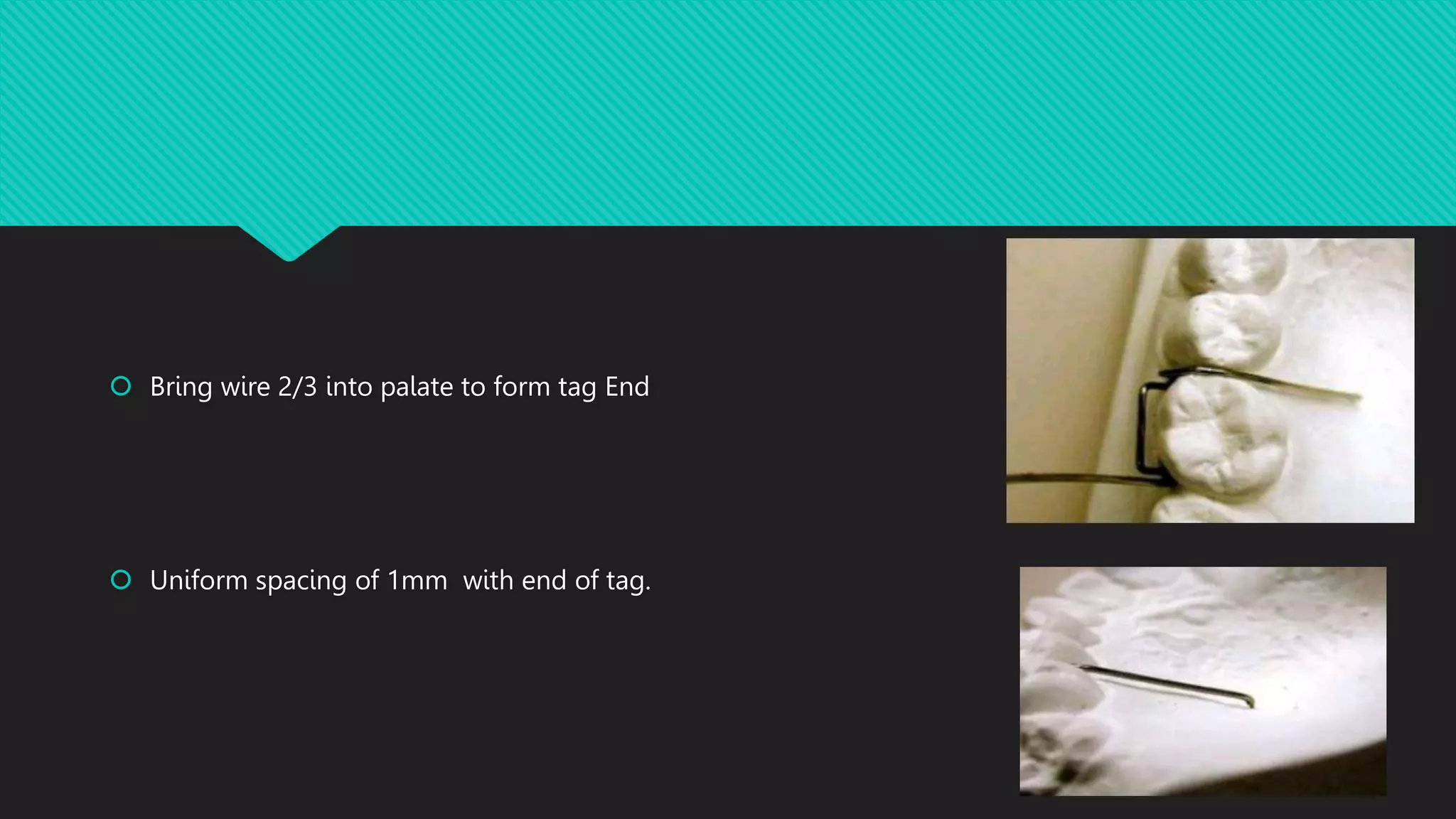 Adams clasp theory and fabrication | PPTX