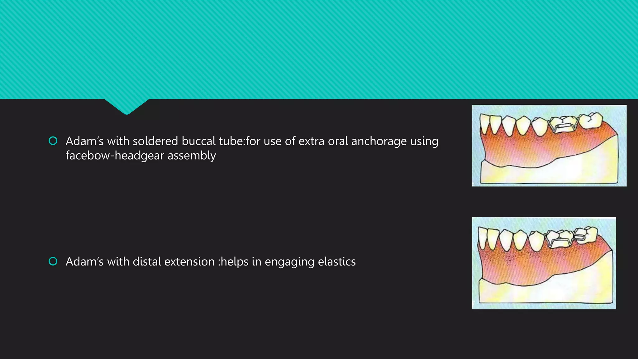 Adams clasp theory and fabrication | PPTX