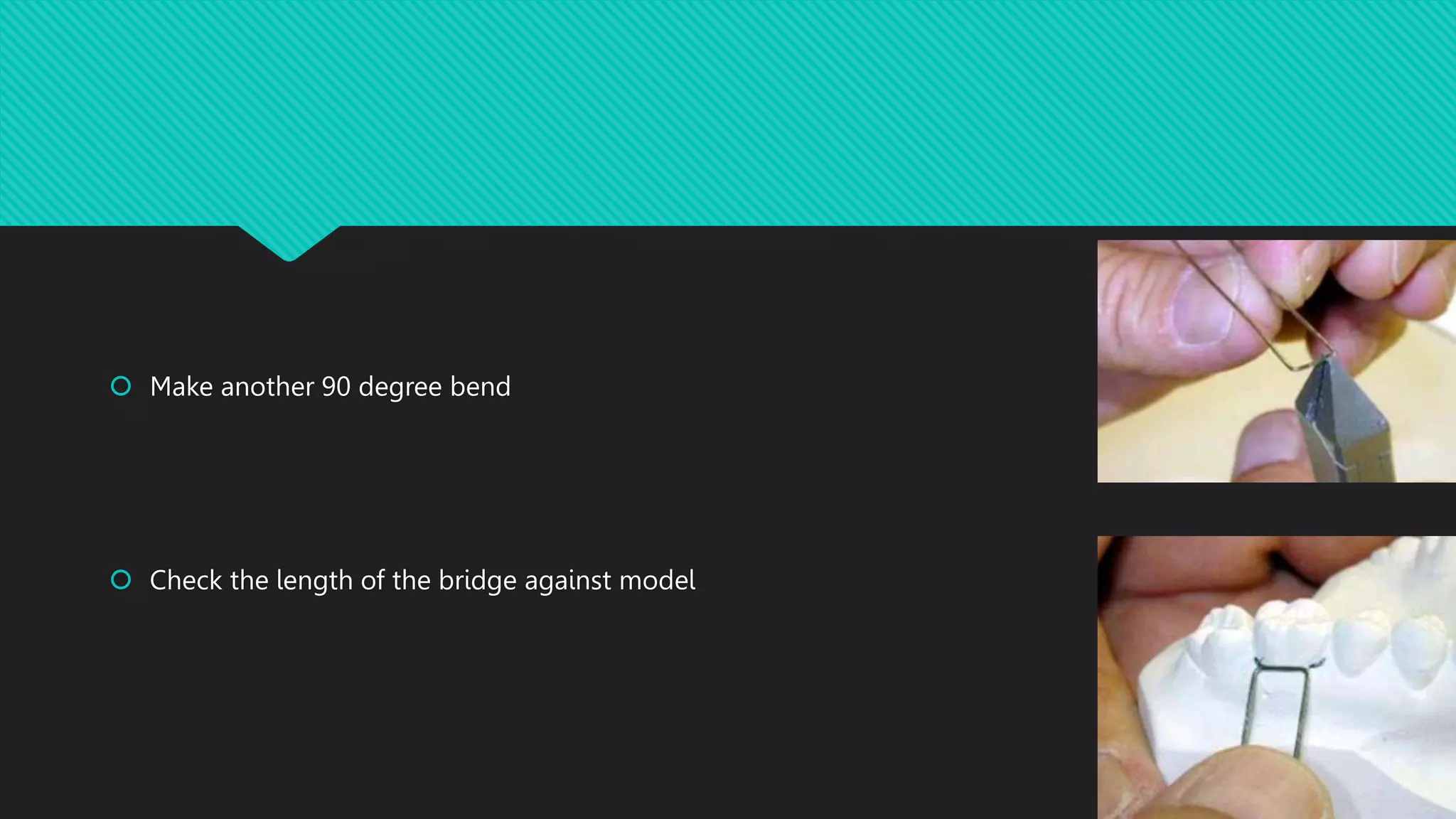 Adams clasp theory and fabrication | PPTX