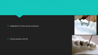 Adams clasp theory and fabrication | PPTX