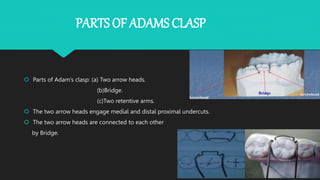 Adams clasp theory and fabrication | PPTX