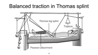 Thomas Splint And Pearson Attachment